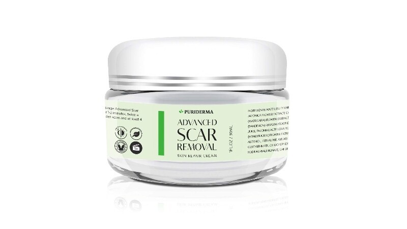 Scar Removal Cream Brands In The Philippines Starting At P58